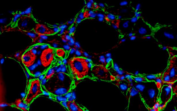 Quantum sensing with laser-synthesized Nano-DIAmond NV color centers ...